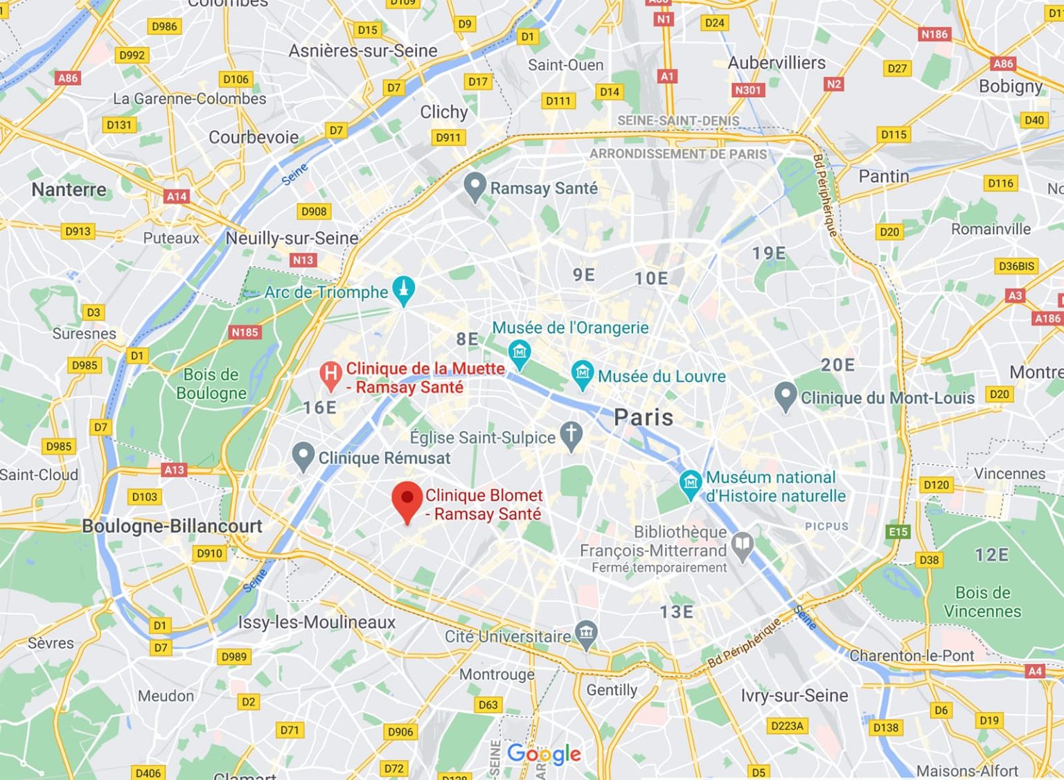 Méniscectomie | Tout savoir sur l'opération du ménisque | CPHG Paris