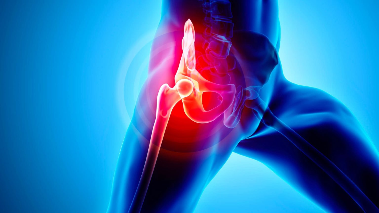 Anatomie de la hanche : os, muscles, moyens d'union, nerfs, vascularisation